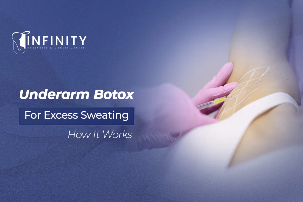 Underarm Botox for Excess Sweating: How It Works | Infinity Aesthetic ...